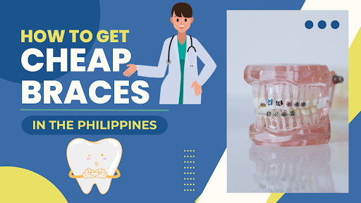 Where to Get Affordable Braces in the Philippines | Get Your Dream ...