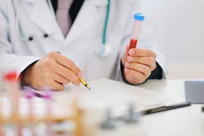 Kadar Hematokrit Tidak Nomal, Waspadai Beragam Penyakit Ini! - Alodokter Kadar Hematokrit Tidak Nomal, Waspadai Beragam Penyakit Ini! - Alodokter