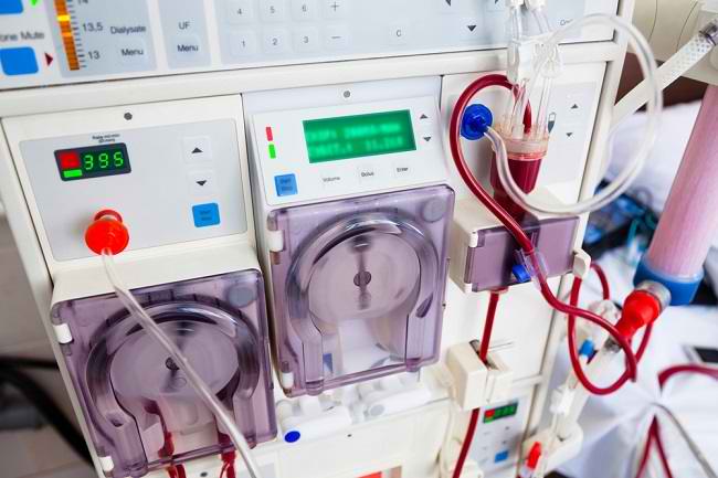 Cuci Darah, Ini yang Harus Anda Ketahui - Alodokter Cuci Darah, Ini yang Harus Anda Ketahui - Alodokter
