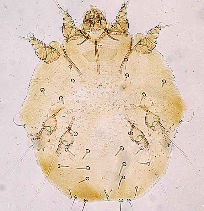 Diagnosis Skabies - Alomedika