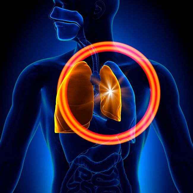 Pneumothorax Patofisiologi Diagnosis Penatalaksanaan Alomedika - Bank2home.com