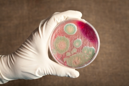 Diagnosis Anthrax - Alomedika