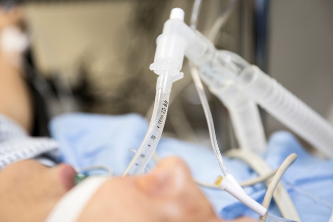 Intubasi dan Ventilasi pada Pasien ARDS dengan COVID-19 - Alomedika
