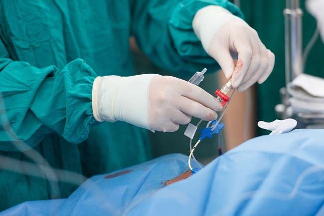 Kista Bartholin - Gejala, penyebab dan mengobati - Alodokter