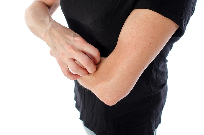 Dapsone - Manfaat, Dosis, dan Efek Samping - Alodokter