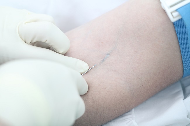 Oxacillin - Manfaat, Dosis, dan Efek Samping - Alodokter