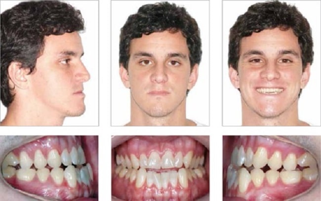 Diagnosis Makrognatia - Alomedika
