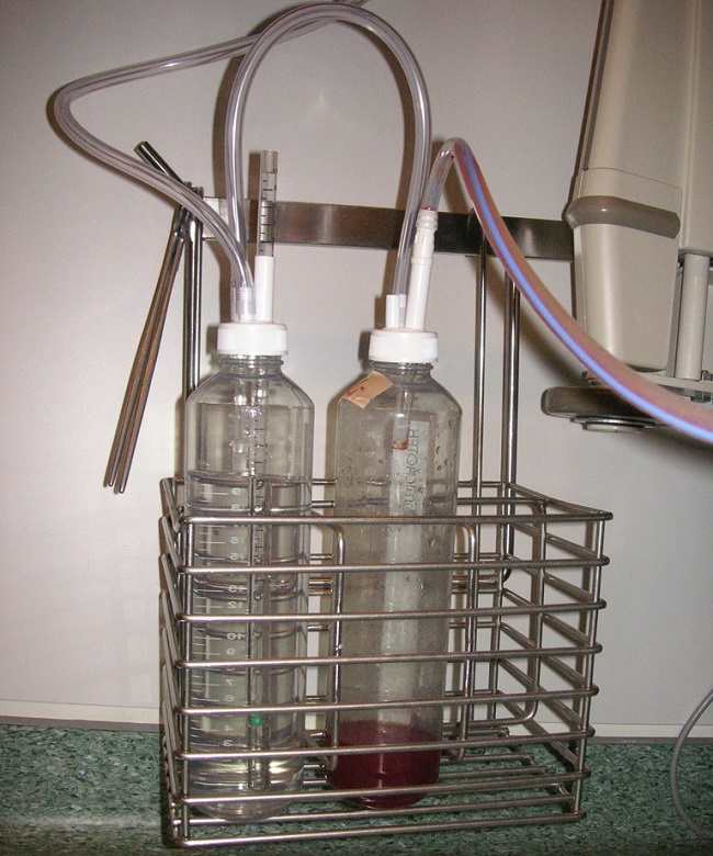 Komplikasi Pemasangan Kateter Interkostal - Alomedika