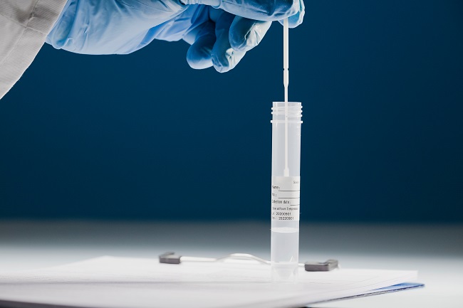 Isothermal Amplification vs RT-PCR sebagai Pemeriksaan Diagnostik COVID ...