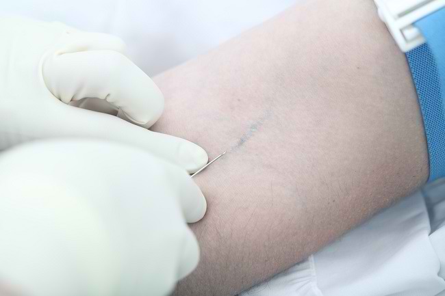 Epoetin Beta - Manfaat, Dosis, dan Efek Samping - Alodokter