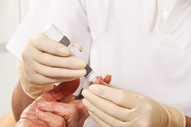 Bile Acid Sequestrant - Manfaat, dosis dan efek samping - Alodokter