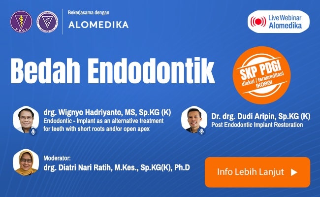 Live Webinar: Bedah Endodontik - Alomedika