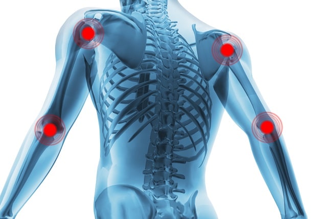 Diagnosis Polyarthralgia - Alomedika