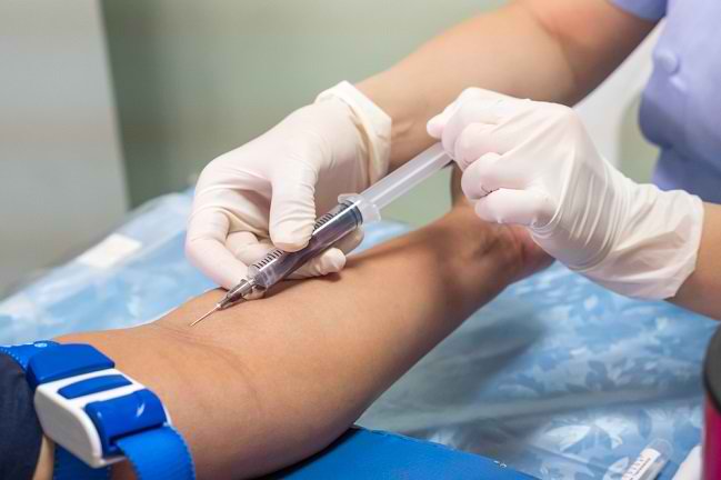 Kenali 4 Penyebab Monosit Tinggi dan Gejala yang Menyertainya - Alodokter