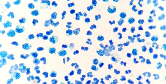 Teknik Pemeriksaan Bakteri Tahan Asam (BTA) - Alomedika