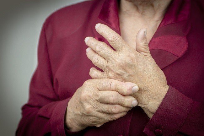 Penghentian DMARDs pada Rheumatoid Arthritis - Alomedika