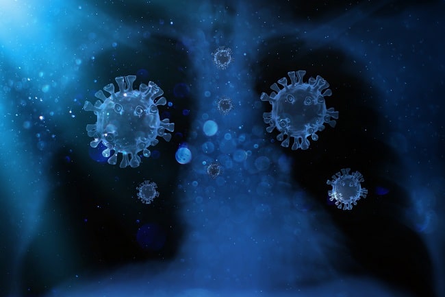 Prognosis COVID-19 (Coronavirus Disease 2019) - Alomedika