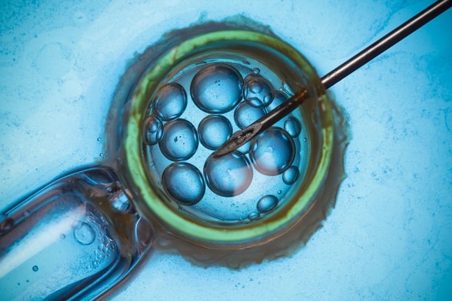 Perbedaan IVF dan IUI