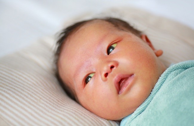 Atresia Bilier - patofisiologi, diagnosis, penatalaksanaan - Alomedika