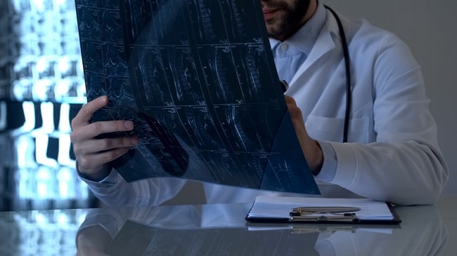 Bukti Ilmiah Peran Steroid pada Cedera Medula Spinalis Akut - Alomedika