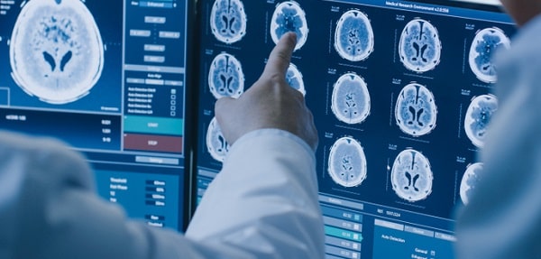 Diagnosis Peningkatan Tekanan Intrakranial: Akurasi Tanda Klinis dan ...