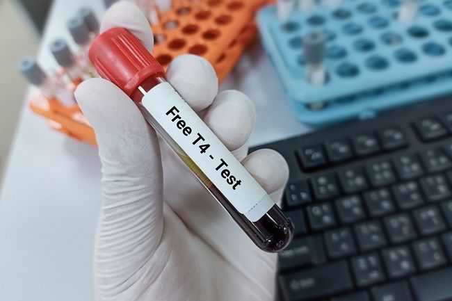 Ketahui Seputar FT4, Pemeriksaan untuk Tiroid - Alodokter Ketahui Seputar FT4, Pemeriksaan untuk Tiroid - Alodokter