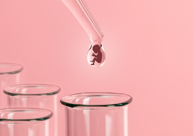 Teknik In Vitro Fertilization/IVF - Alomedika