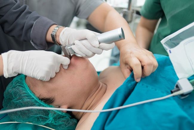 Mengenal Laringoskopi, Prosedur Pemeriksaan Tenggorokan - Alodokter Mengenal Laringoskopi, Prosedur Pemeriksaan Tenggorokan - Alodokter