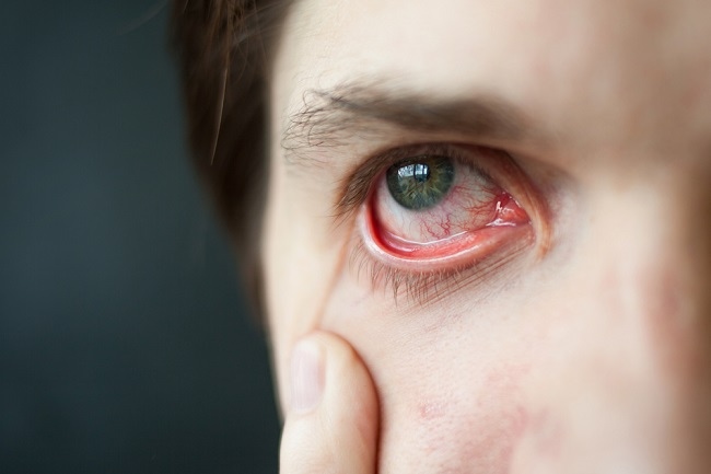 Terramycin - Manfaat, dosis dan efek samping - Alodokter