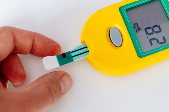 Hiperurisemia - patofisiologi, diagnosis, penatalaksanaan - Alomedika