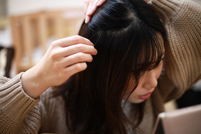 Tetap Percaya Diri meski Rambut Beruban di Usia Muda - Alodokter Tetap Percaya Diri meski Rambut Beruban di Usia Muda - Alodokter