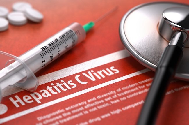 Hepatitis C - patofisiologi, diagnosis, penatalaksanaan - Alomedika