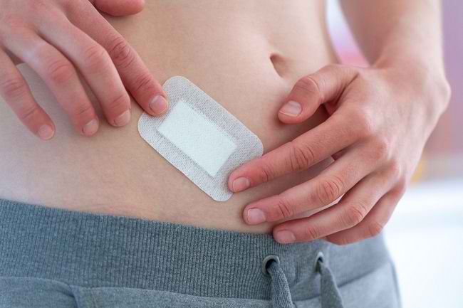 Ketahui Lama Penyembuhan Luka Operasi dan Faktor yang Memengaruhinya ...