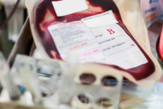 4 Fakta Golongan Darah B yang Menarik untuk Diketahui - Alodokter