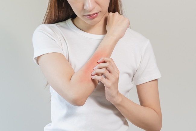 Desonide - Manfaat, dosis dan efek samping - Alodokter