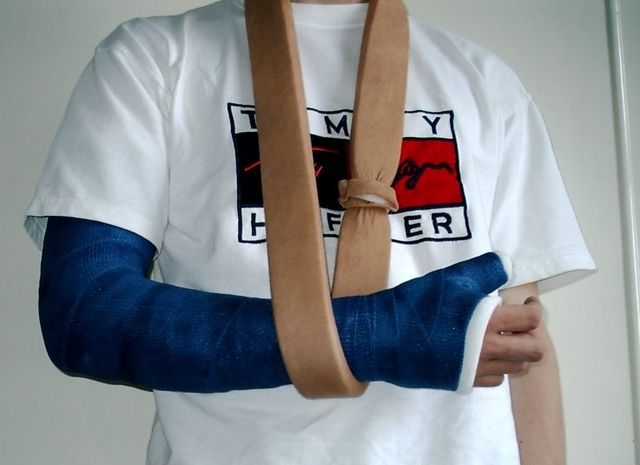 Teknik Arm Sling - Alomedika