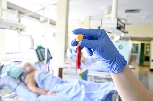 Prokalsitonin Vs C-Reactive Protein Sebagai Penanda Sepsis Di ICU ...