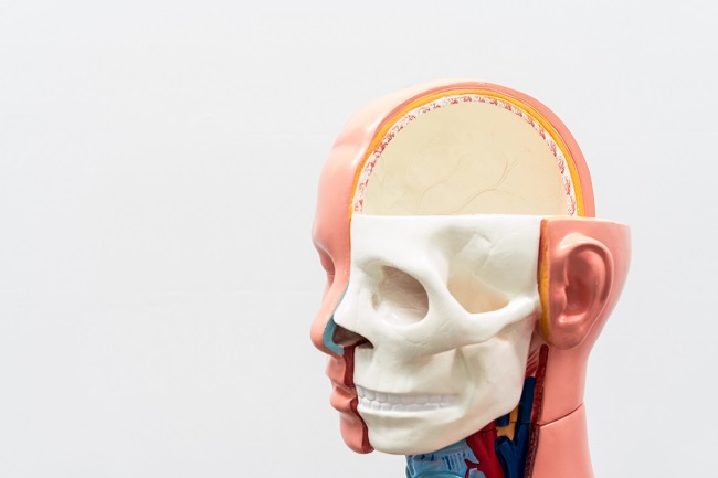 Kapan dilakukan Tindakan Non Operatif pada Perdarahan Intraserebral ...