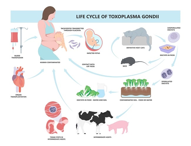Toxoplasmosis - patofisiologi, diagnosis, penatalaksanaan - Alomedika