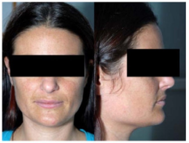 Diagnosis Addison Disease - Alomedika