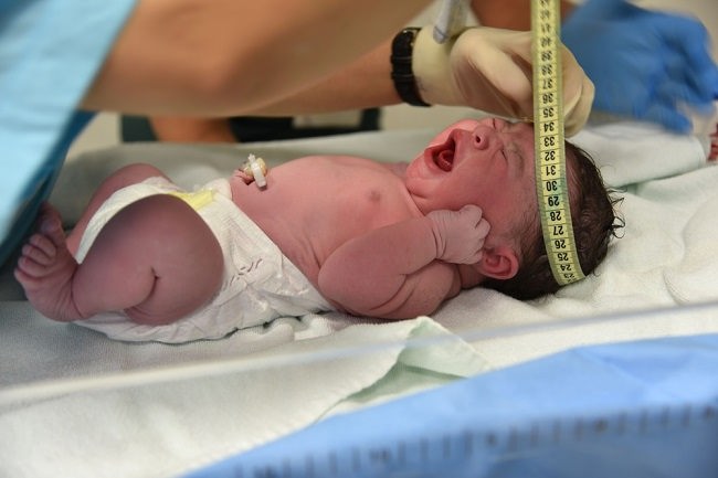 Penyebab Hidrosefalus Beserta Faktor Risiko dan Penanganannya - Alodokter