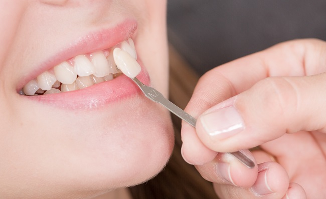 Teknik Crown Gigi - Alomedika