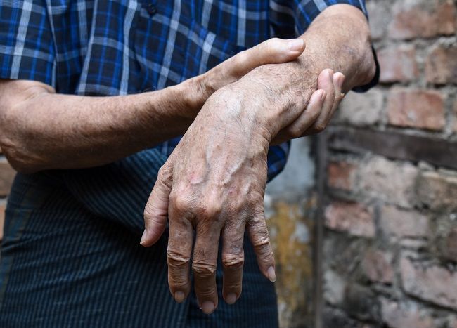 Pyridostigmine - Manfaat, Dosis, dan Efek Samping - Alodokter