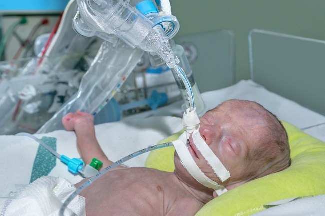 Teknik Terapi CPAP Alomedika, 50% OFF | www.pinnaxis.com