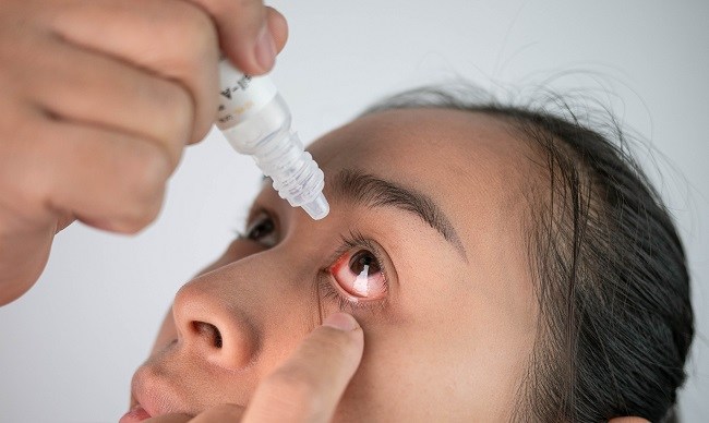 Natamycin - Manfaat, Dosis, dan Efek Samping - Alodokter