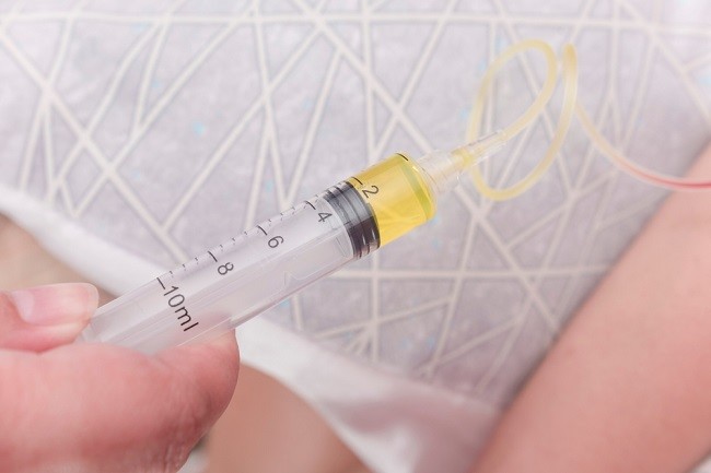 Infus Whitening, Kenali Kandungan dan Efek Sampingnya - Alodokter