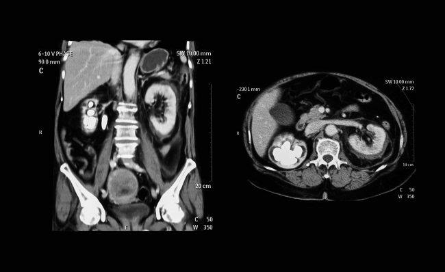 Teknik CT Scan Abdomen - Alomedika