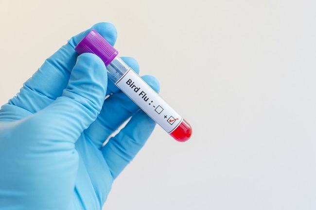 Flu Burung, Kenali Gejala dan Penanganannya - Alodokter