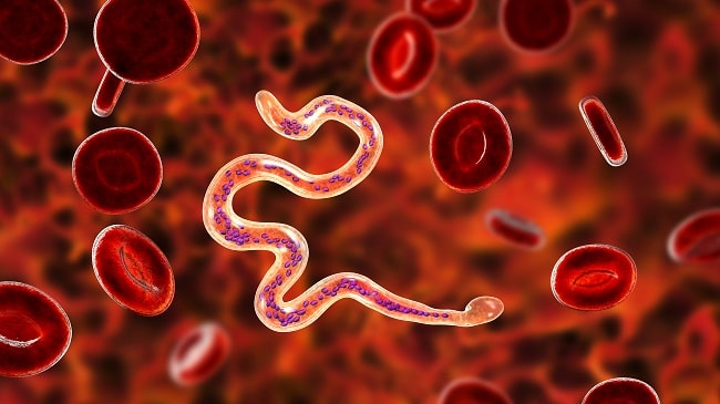 Penatalaksanaan Filariasis - Alomedika