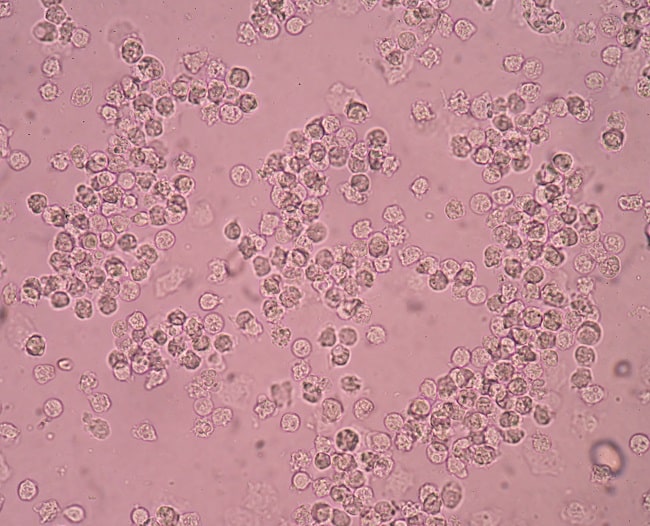 Uretritis Non-gonore - patofisiologi, diagnosis, penatalaksanaan ...